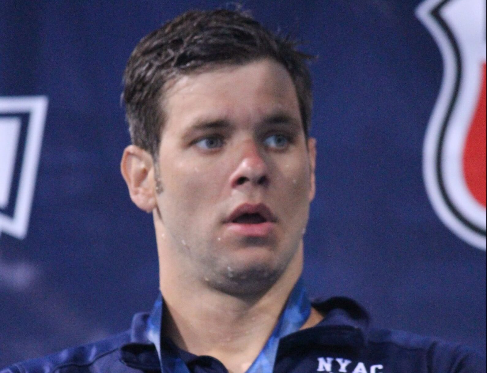 Stomach Ailment Affecting David Plummer's Performance At Worlds